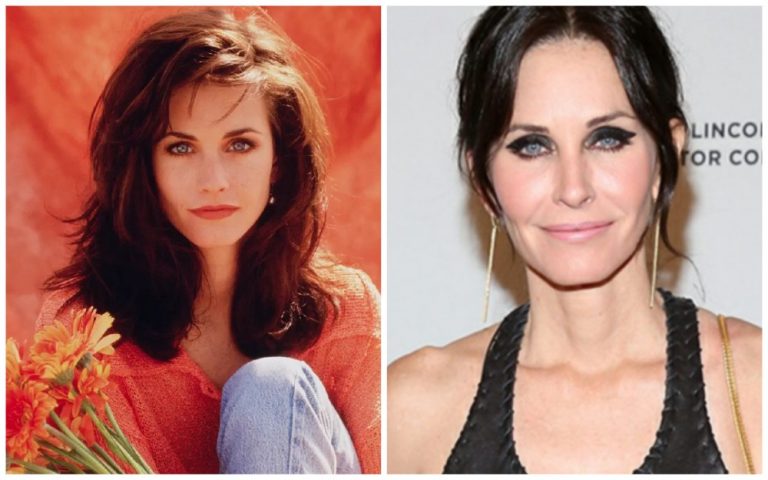 Failed Plastic Surgeries: 30 victims of beauty - Inpic.net